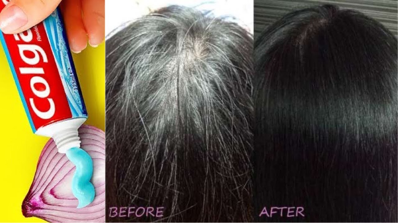 Turn Gray Hair to Black with Onion and Toothpaste at Home - YouTube