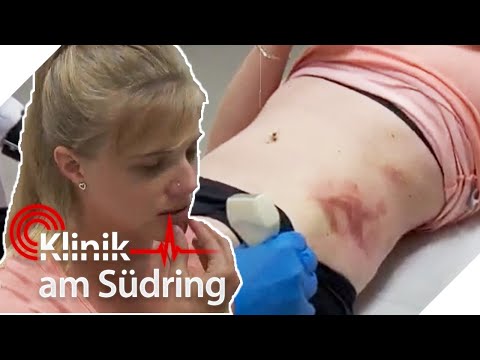 Starke Hüftschmerzen! Wovon kommen die Hämatome?  | Klinik am Südring | SAT.1