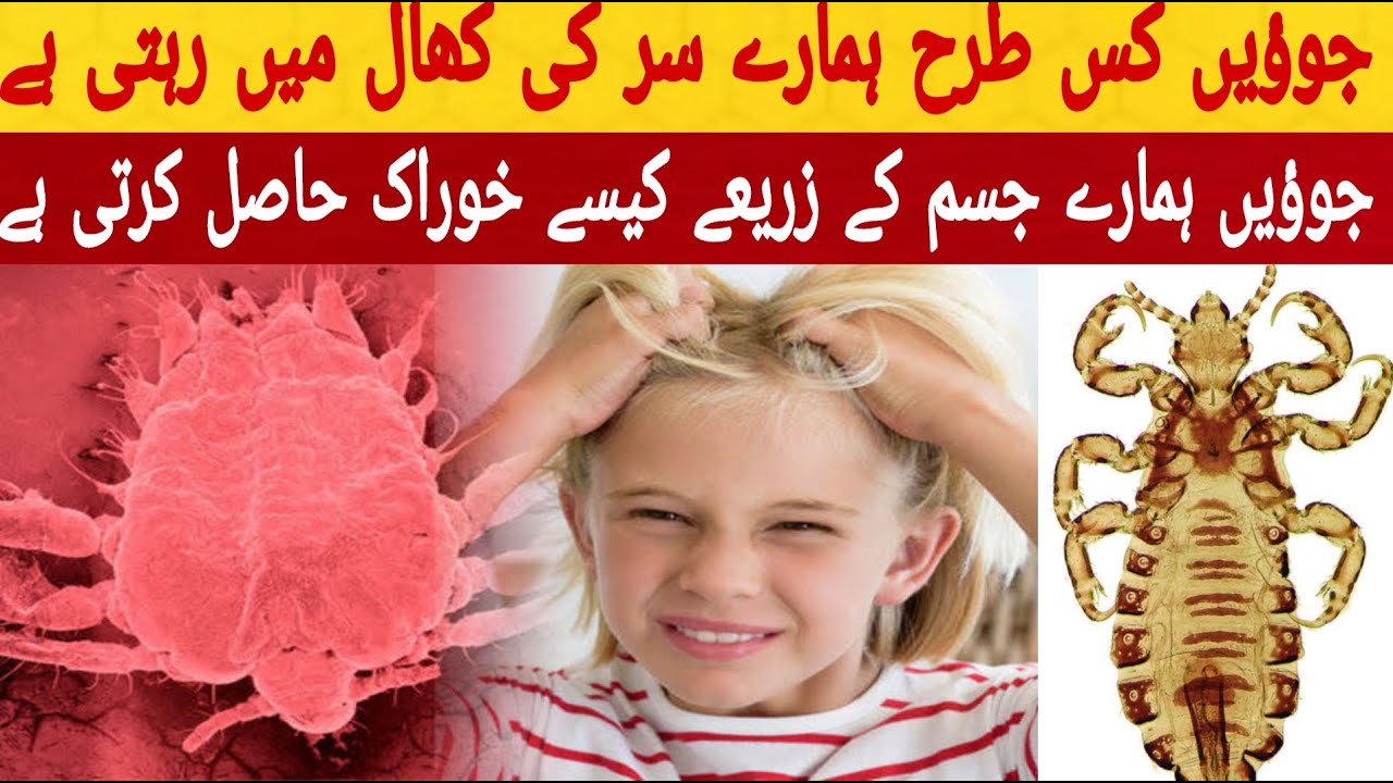 How do lice get food through our body | Head Lice | Deep Look | Dekho ...