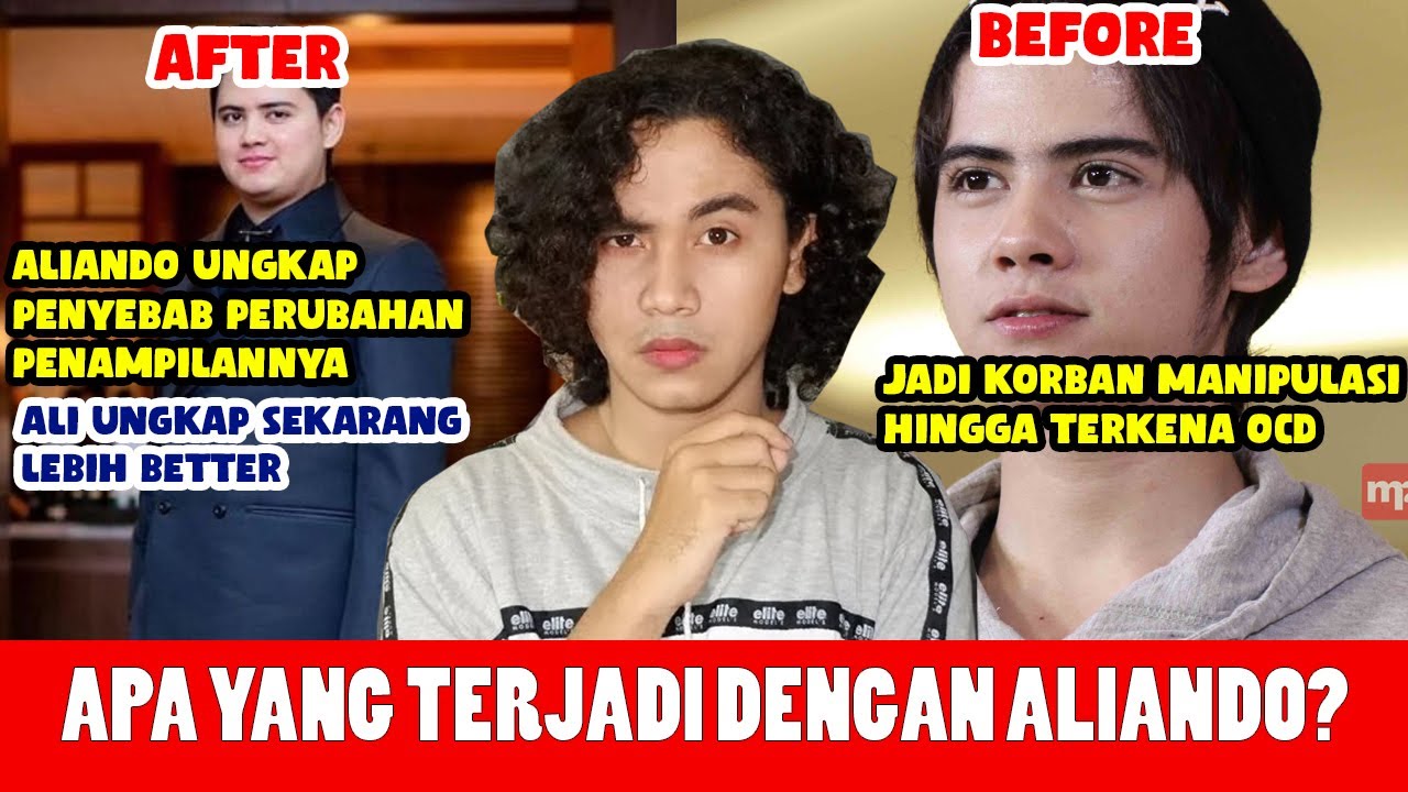 Kisah Aliando Syarief Terkena OCD Hingga Perubahan Penampilannya ...