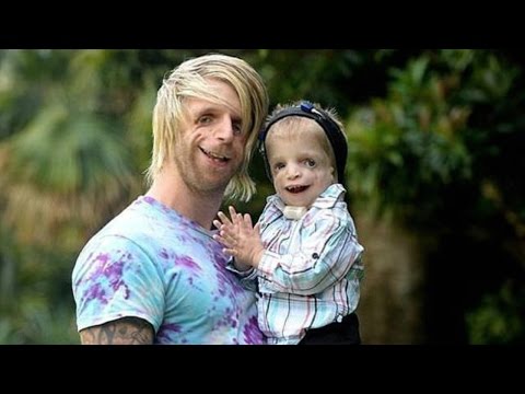 НОЁБ КАСАЛЛИК / КИЗИКАРЛИ ДУНЁ / УЗБЕК ТИЛИДА