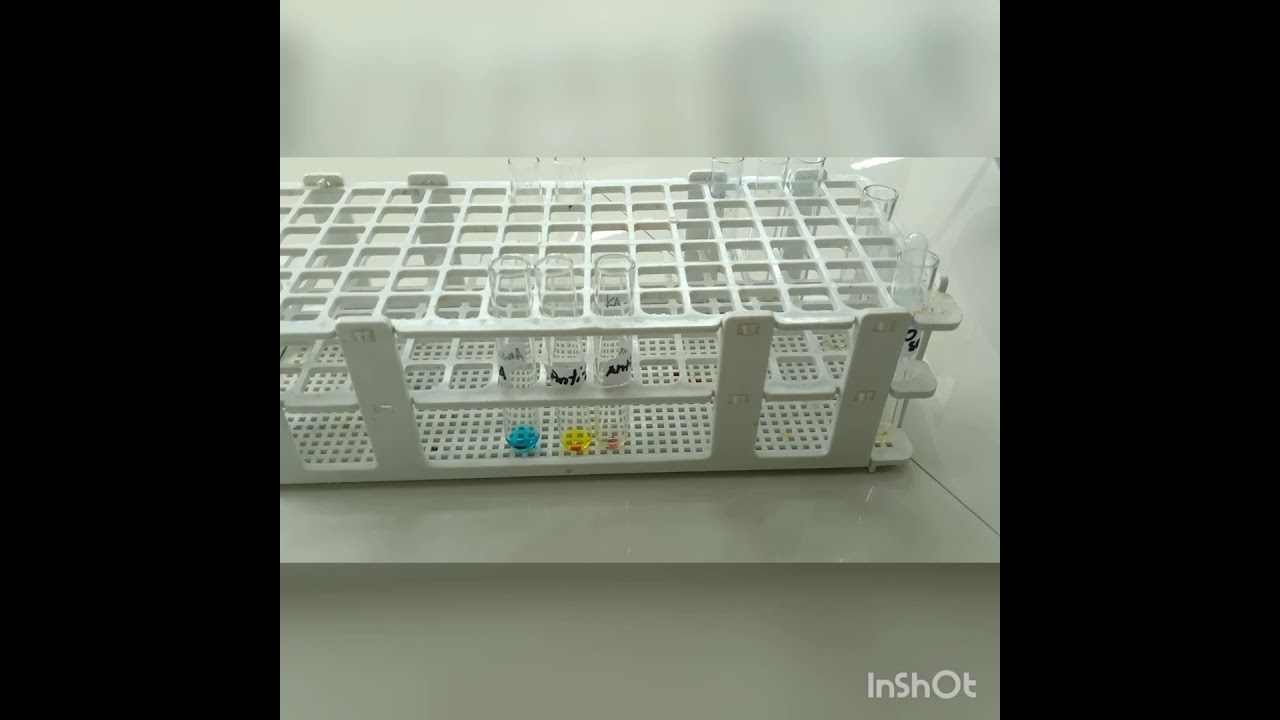 Direct ABO Blood Grouping (Tube Method) / Forward Typing - YouTube