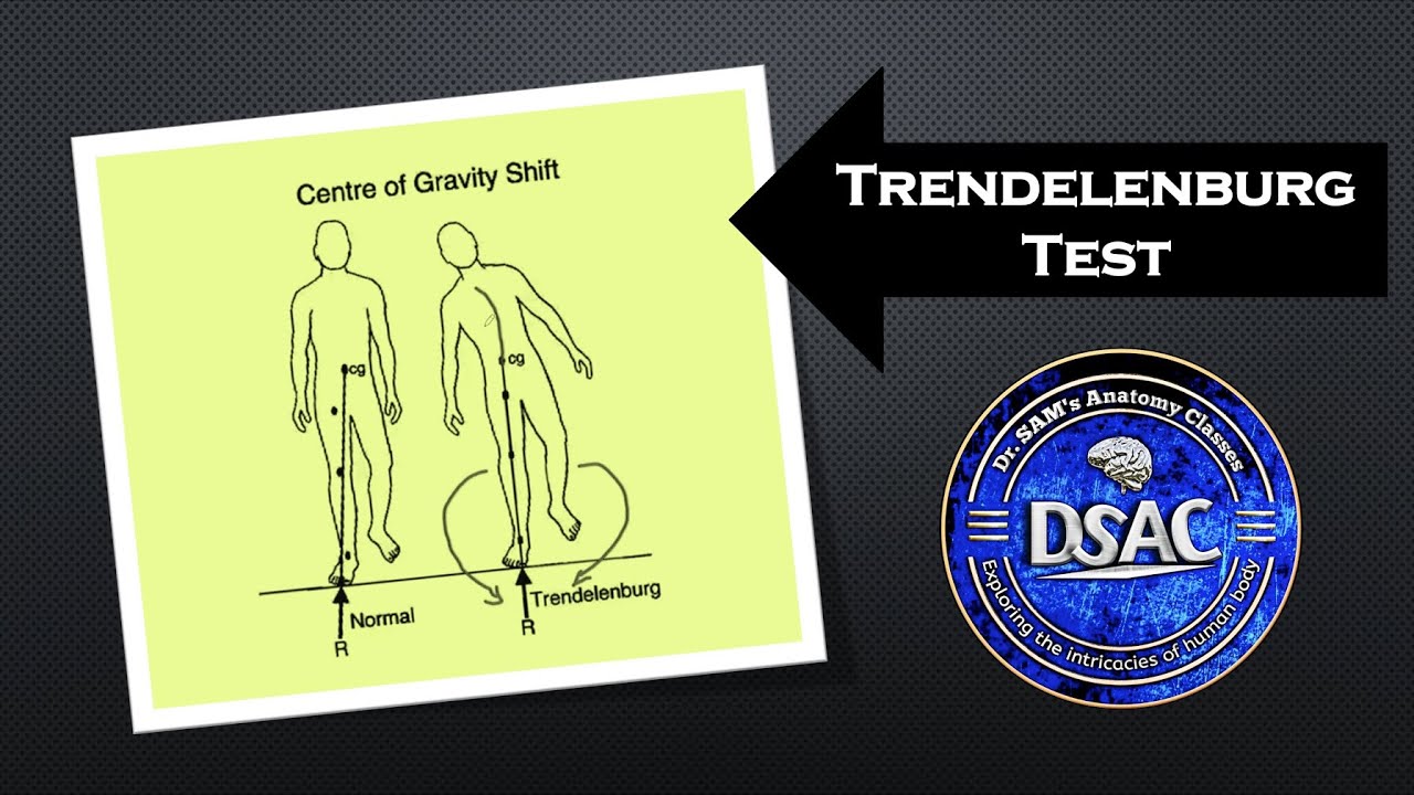 Trendelenburg test | Trendelenburg sign | Trendelenburg gait | Lurching ...