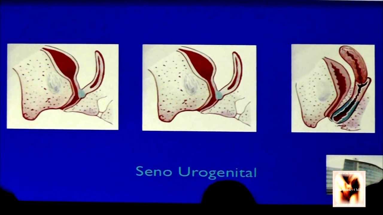 NINFAS DE ROKITANSKY: Primera Conferencia Medica dedicada a mujeres con ...