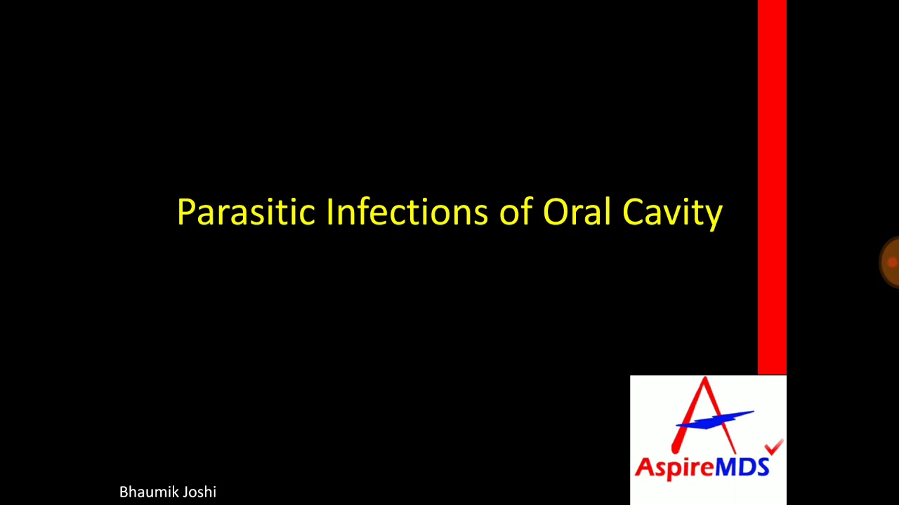 Parasitic Infections of Oral Cavity - YouTube