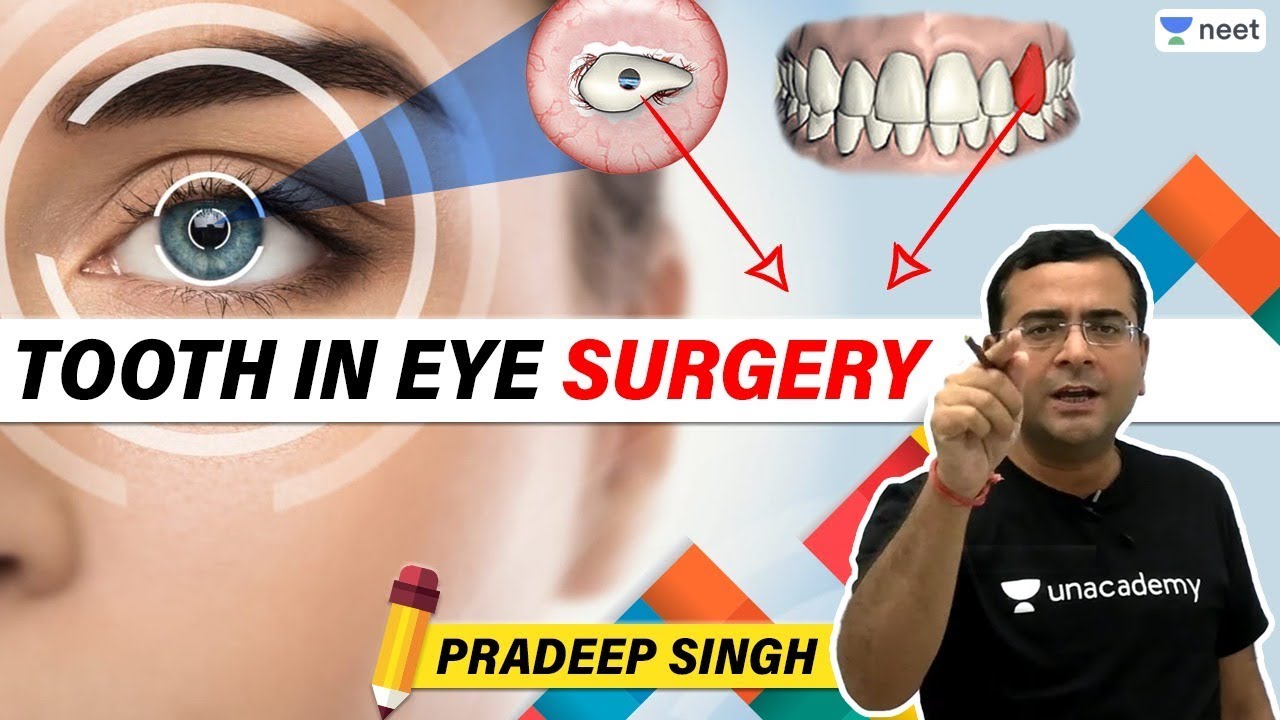 NEET Knowledge: “Tooth-in-Eye” Surgery | Unacademy NEET | Pradeep Singh ...