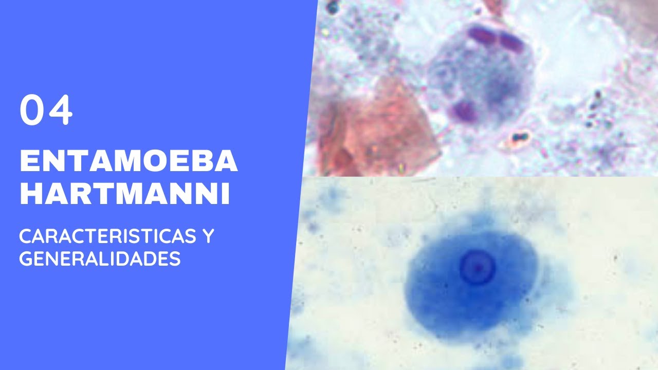 Entamoeba hartmanni 4.0 ||Parasitología || Amebas || Amebiasis ...