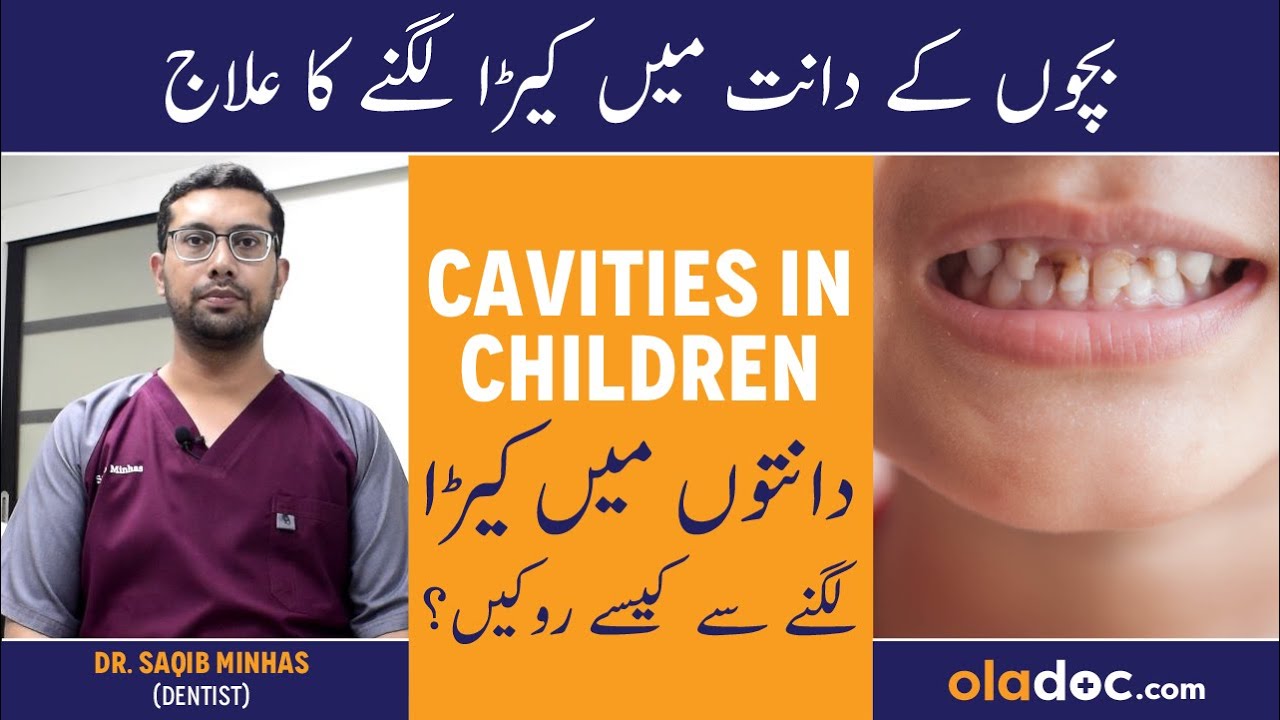 CAVITIES IN KIDS - Bacho Ke Dant Me Kida Lag Jaye To Kya Karen- Tooth ...