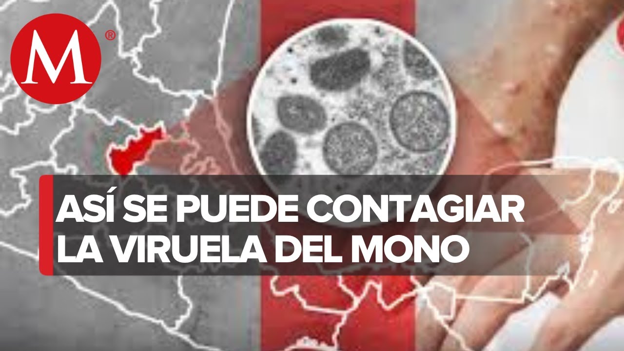 OMS indica las diferentes formas de contagio sobre la viruela símica ...