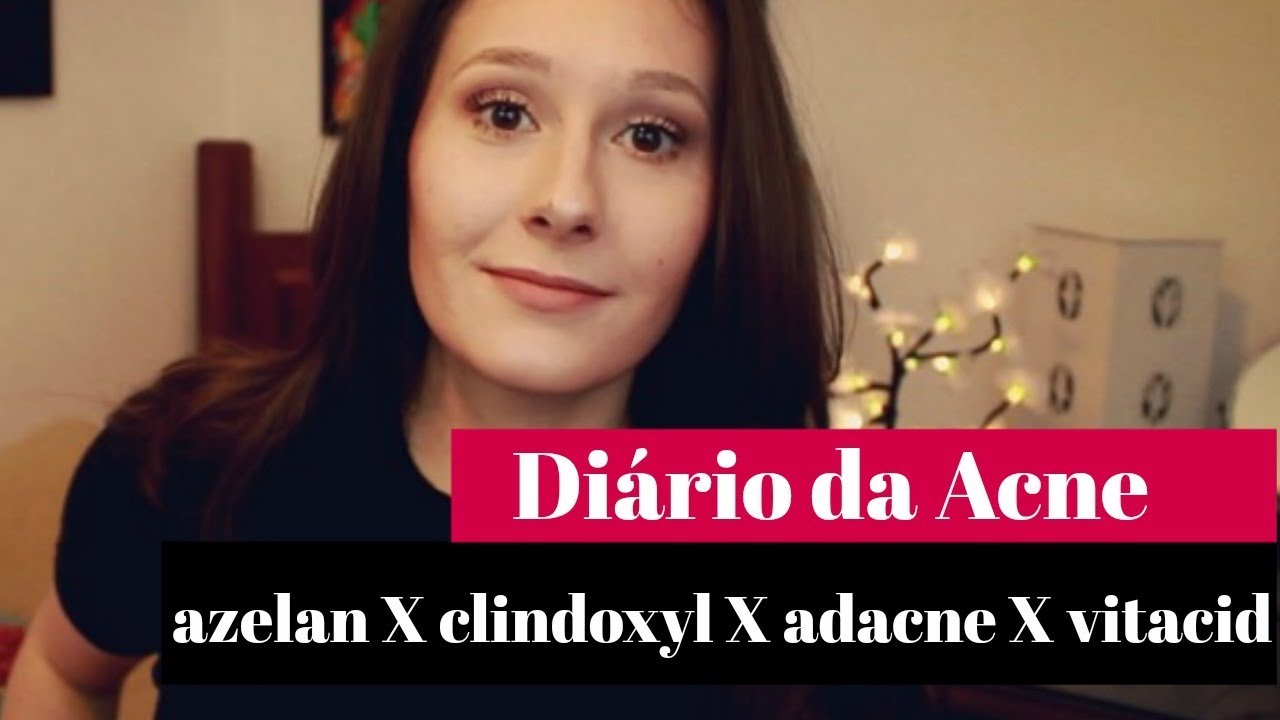 Qual o melhor creme para ACNE? - por Letícia Menezes - YouTube
