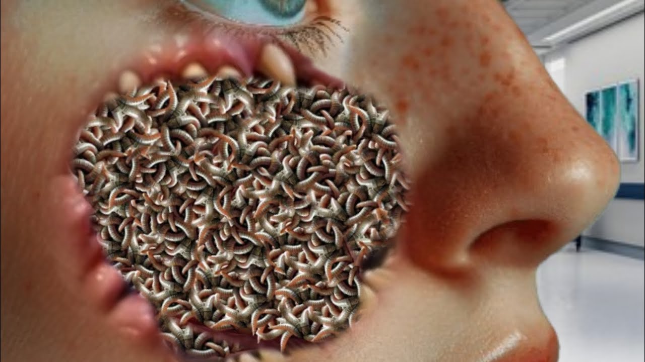 ASMR | Make cheeks soft and smooth | Asmr cheeks animation treatment ...