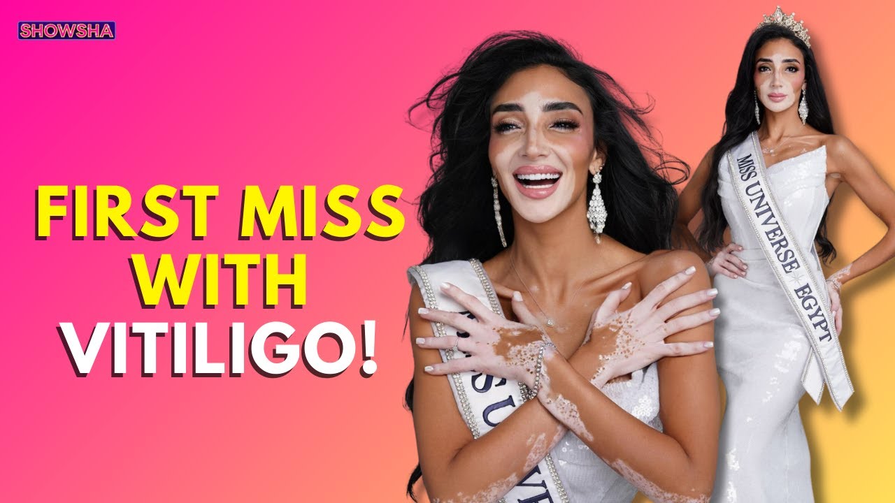 Miss Egypt Universe, First-Ever Contestant With Vitiligo Champions Body ...