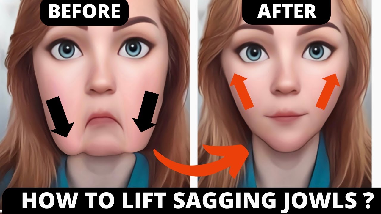 Lift Sagging Cheeks & Jowls Naturally | Face Yoga for Saggy Jowls ...