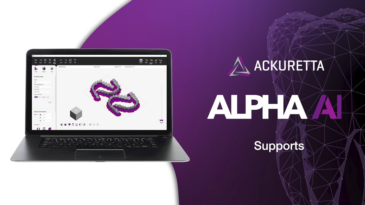 ALPHA AI - Supports - YouTube