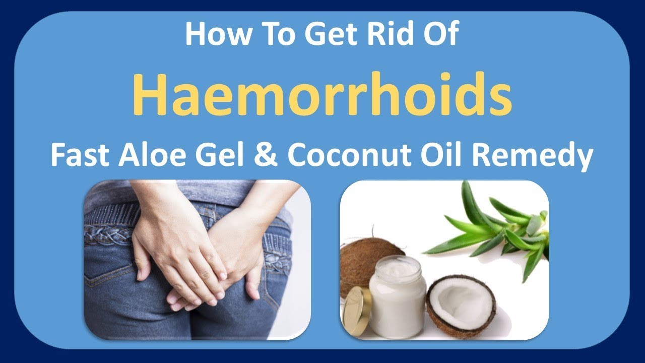 how to get rid of hemorrhoids fast - Aloe gel & coconut oil Remedy ...