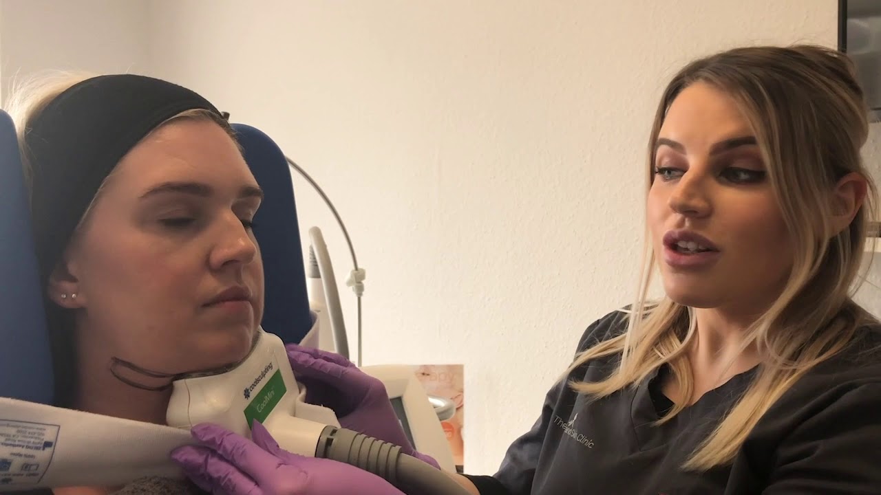 CoolSculpting: Double Chin | The Laser and Skin Clinic - YouTube