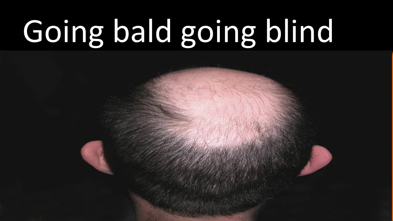Going bald going blind (metal song) - YouTube