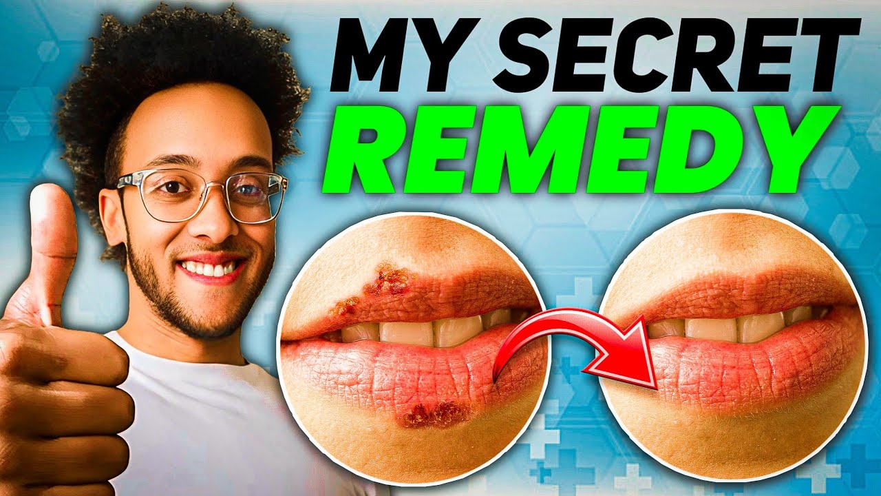 How to get Rid of cold sore fast and treatment remedies | Step by Step ...
