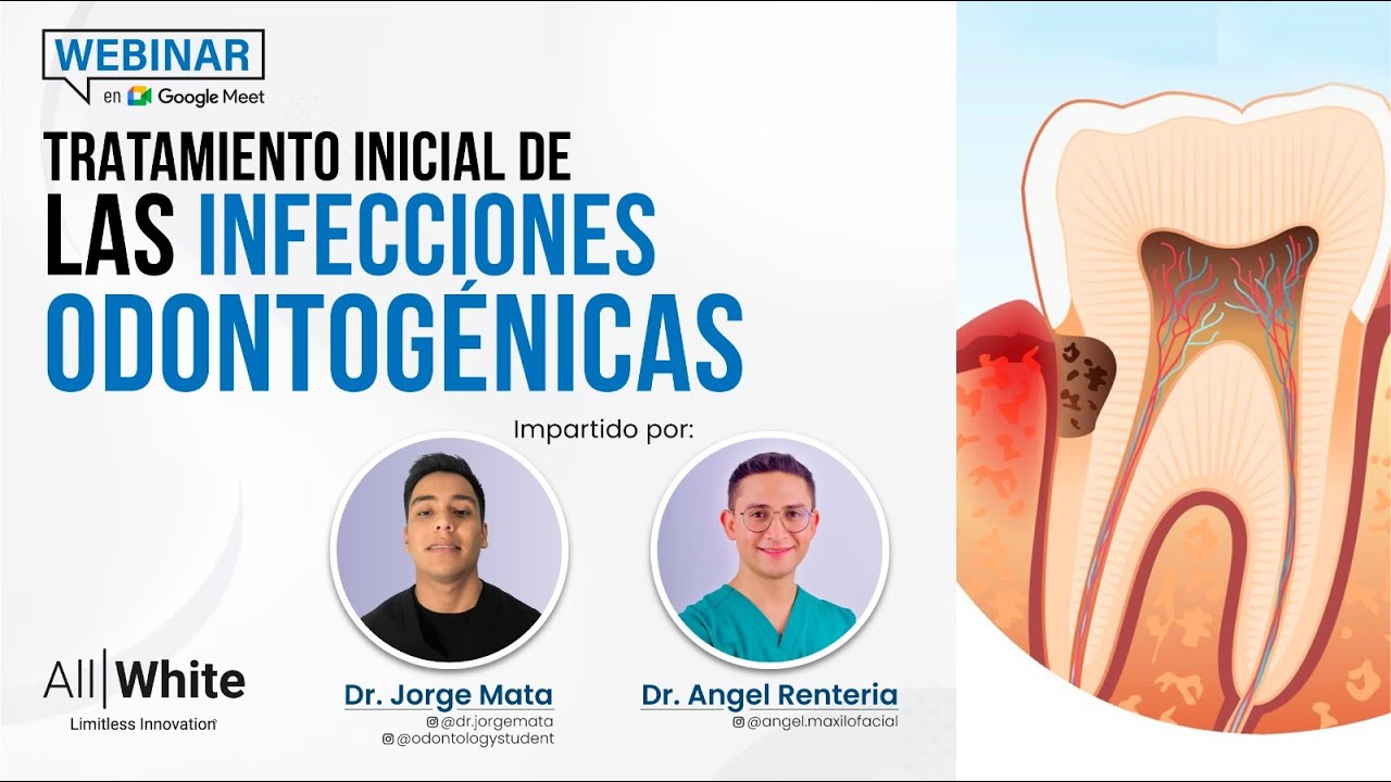 Tratamiento Inicial de las Infecciones Odontogénicas - Dr. Angel ...