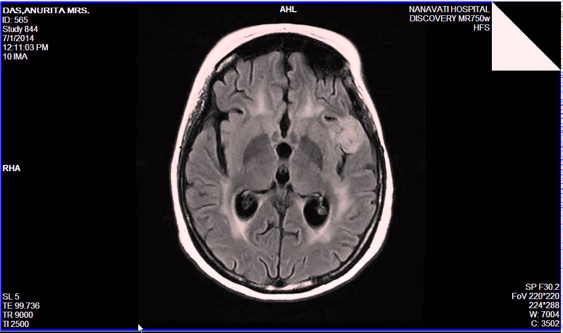 AX T2 Flair 02nd July 2014 - YouTube