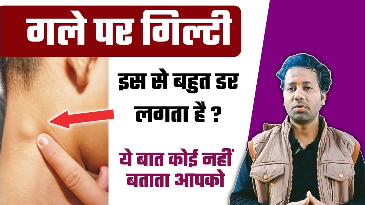छोटे बच्चो की गले की गांठ | Neck cyst | neck lump ? dr tarun - YouTube