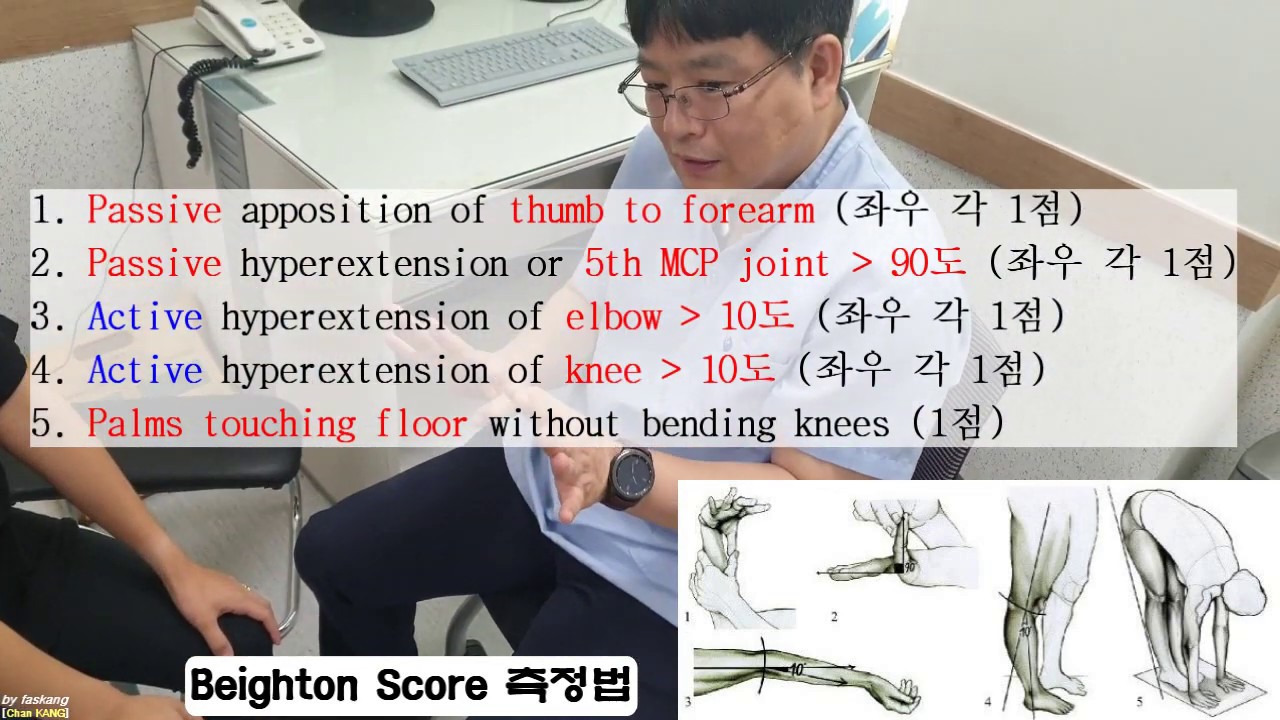 252.(의사용.Physical exam) Beighton score: Hypermobility & Ligament laxity ...