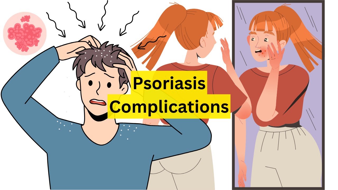 Psoriasis Complications Explained What You Need To Know Youtube