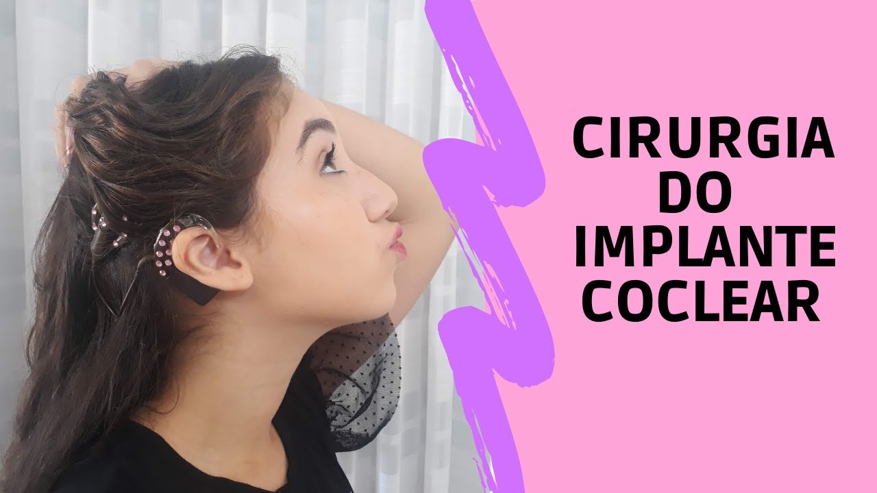 COMO OCORRE A CIRURGIA DO IMPLANTE COCLEAR - YouTube