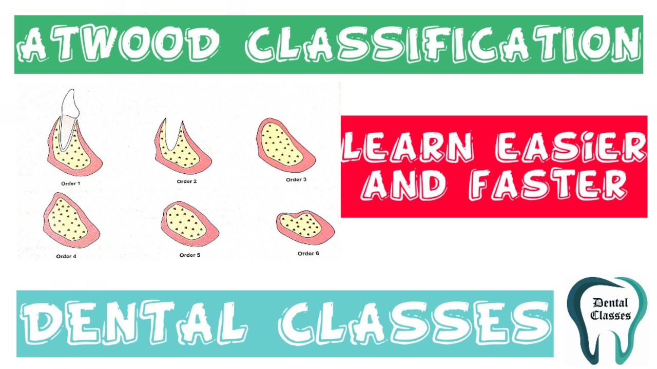 Atwood Classification / NEET MDS CAPSULE #mds #dental #neetmds # ...