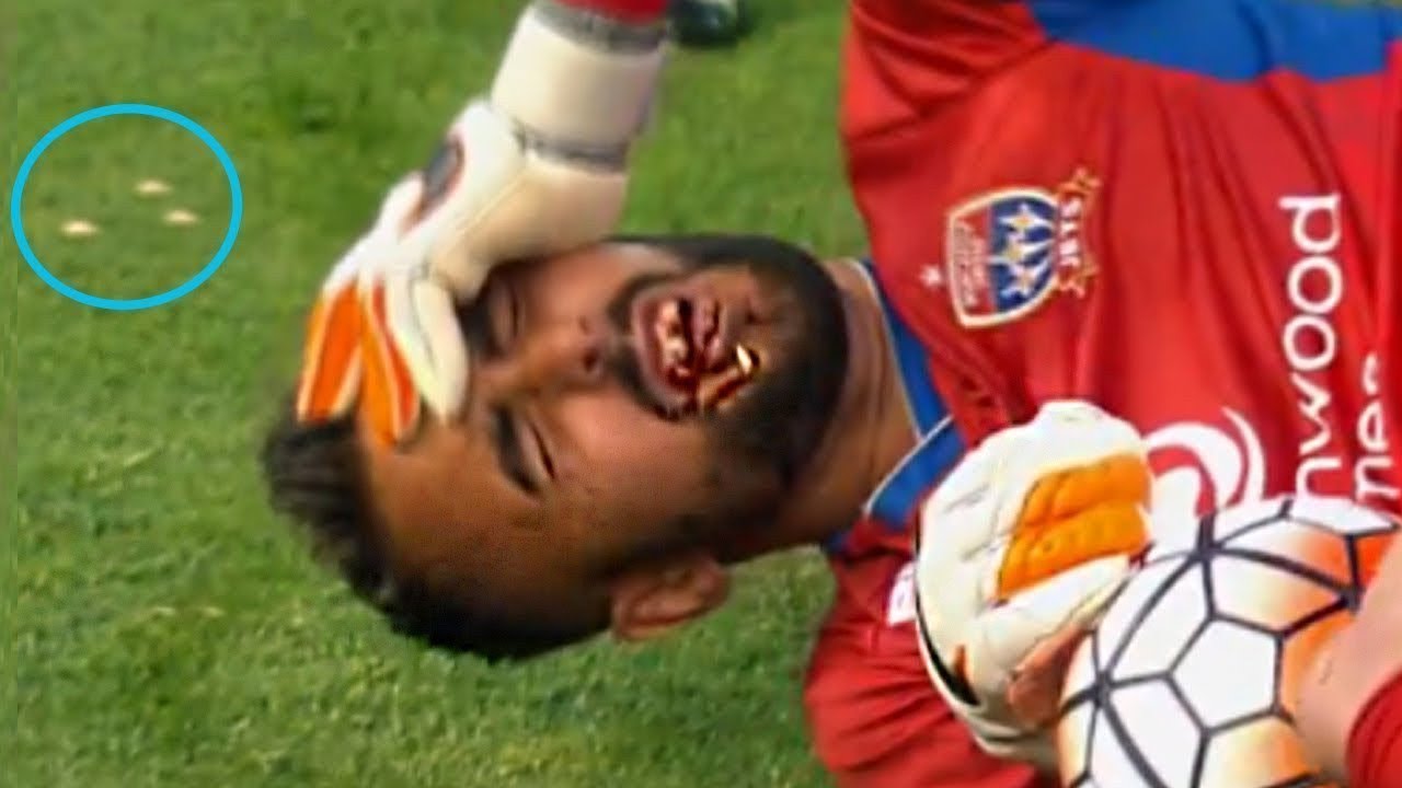 Top 15 Players Lost Teeth During Football Match - YouTube