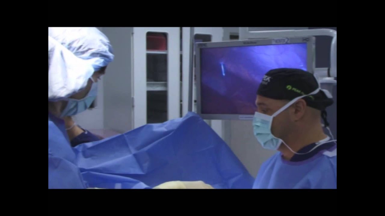 Colleen Kennedy, MD - Gastric Bypass.wmv - YouTube