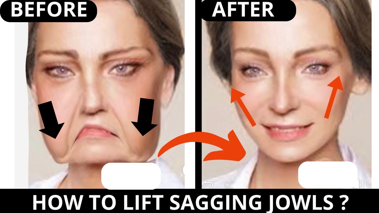 FACIAL EXERCISES FOR JOWLS AND MARIONETTE LINES ! LAUGH LINES, SAGGING ...