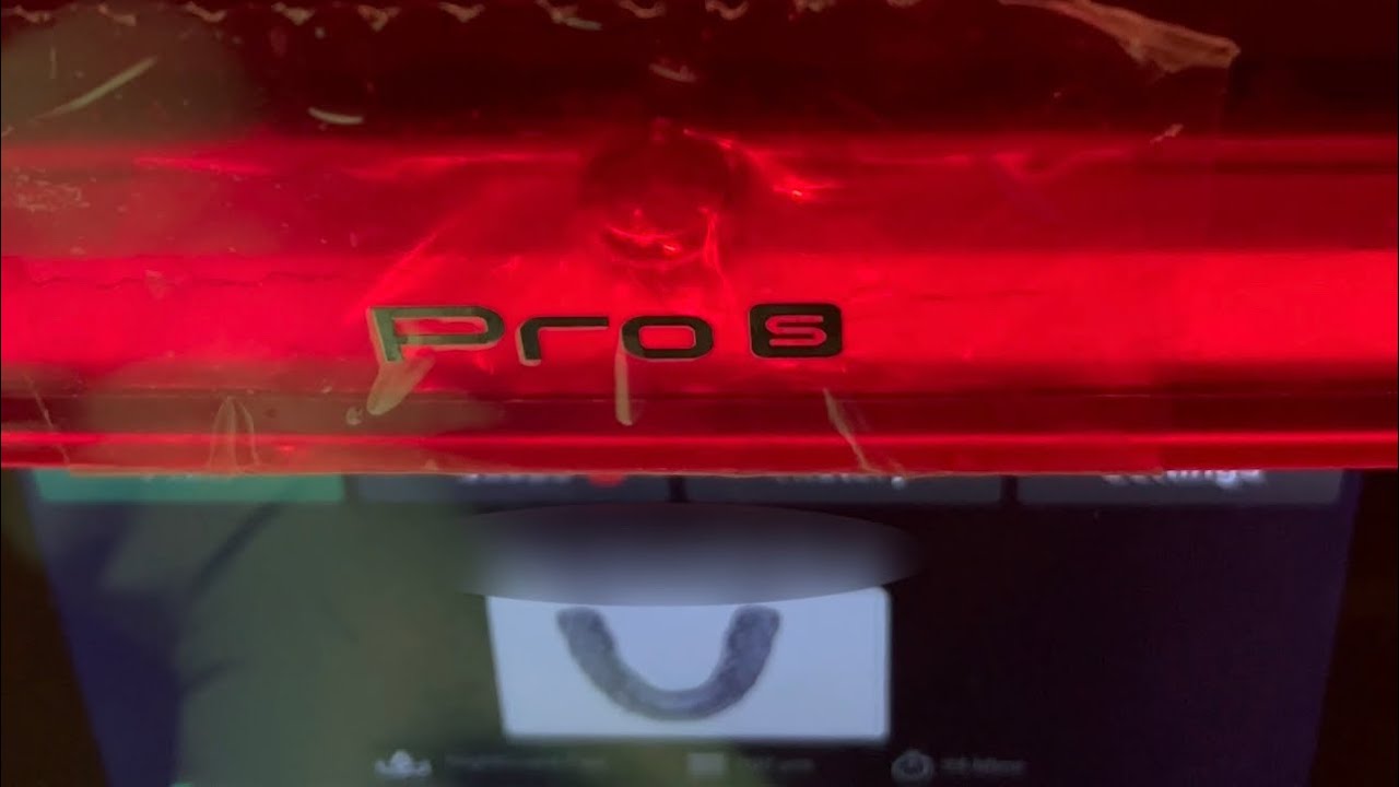 3D printing of a night guard using Nightguard Flex on the SprintRay Pro ...