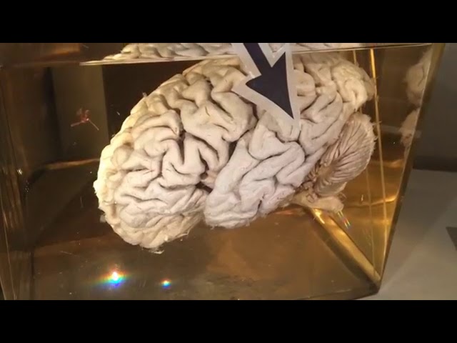 El Cerebro De Albert Einstein En El Museo