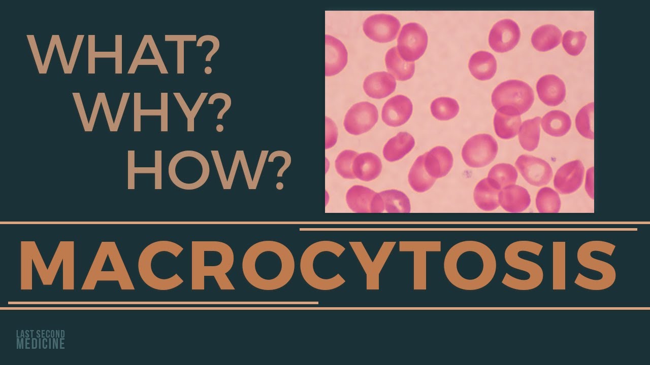 Macrocytosis