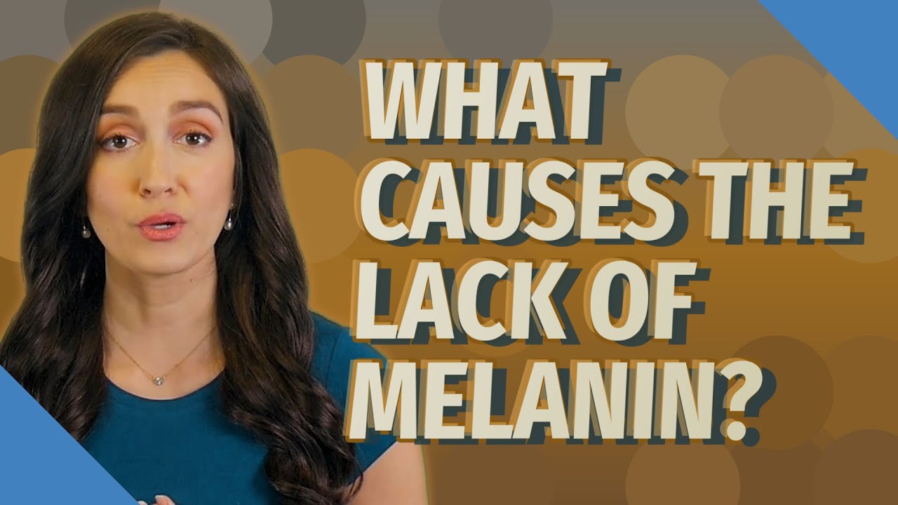 What causes the lack of melanin? - YouTube