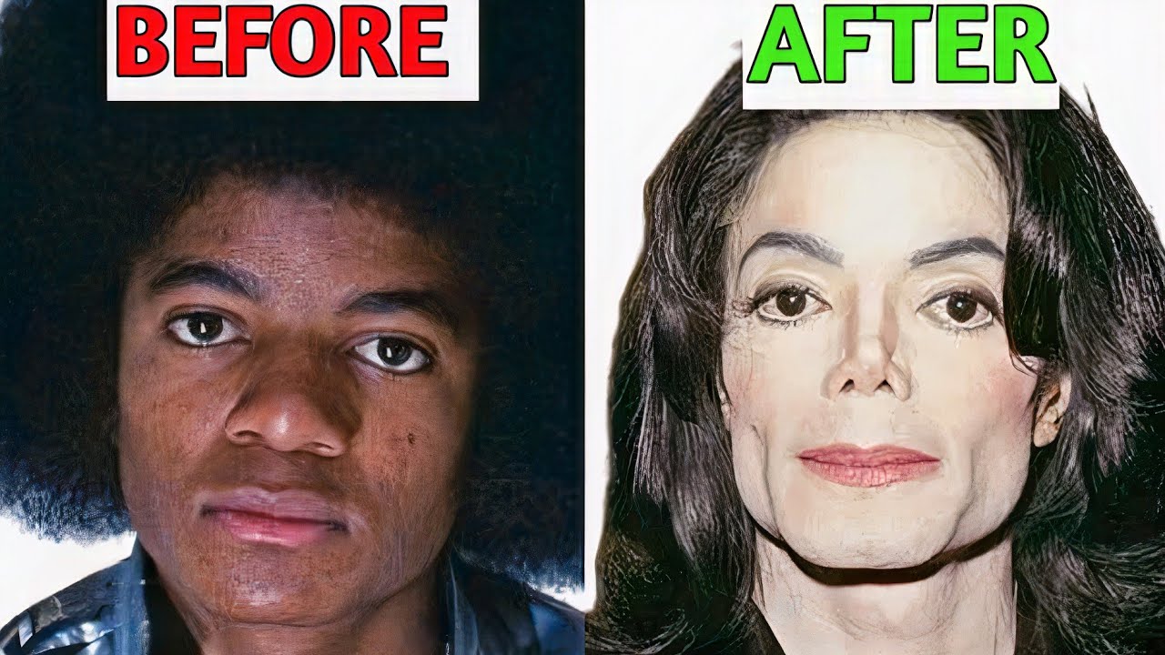 The Evolution Of Michael Jackson’s Face | Plastic Surgery Analysis ...