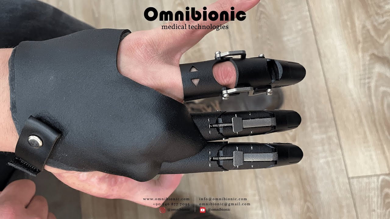 PMCFinger | Mechanical Finger Prosthestics | Bionic Finger | Omnibionic ...