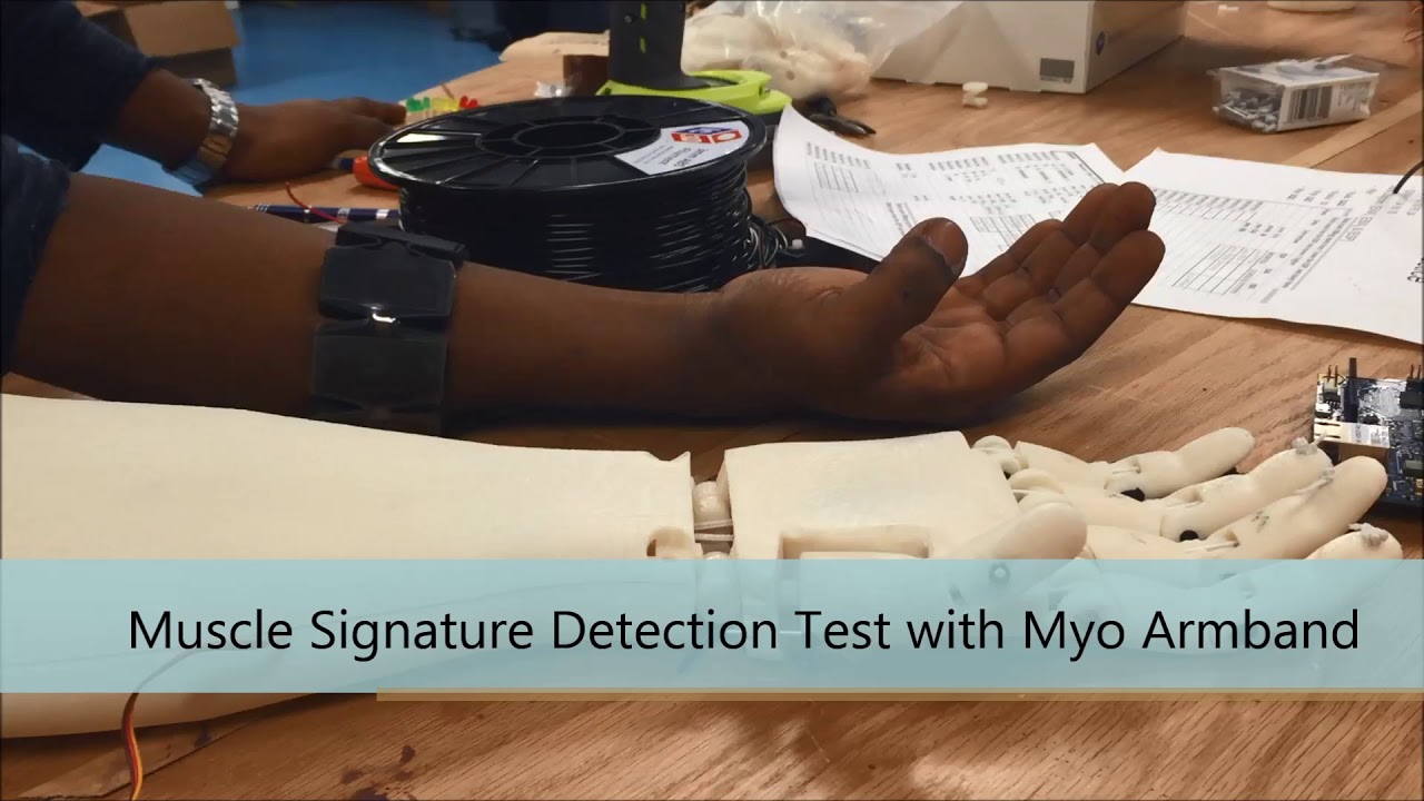 3D Printed Prosthetic Hand Actuation Using Myo Gesture Control Armband ...