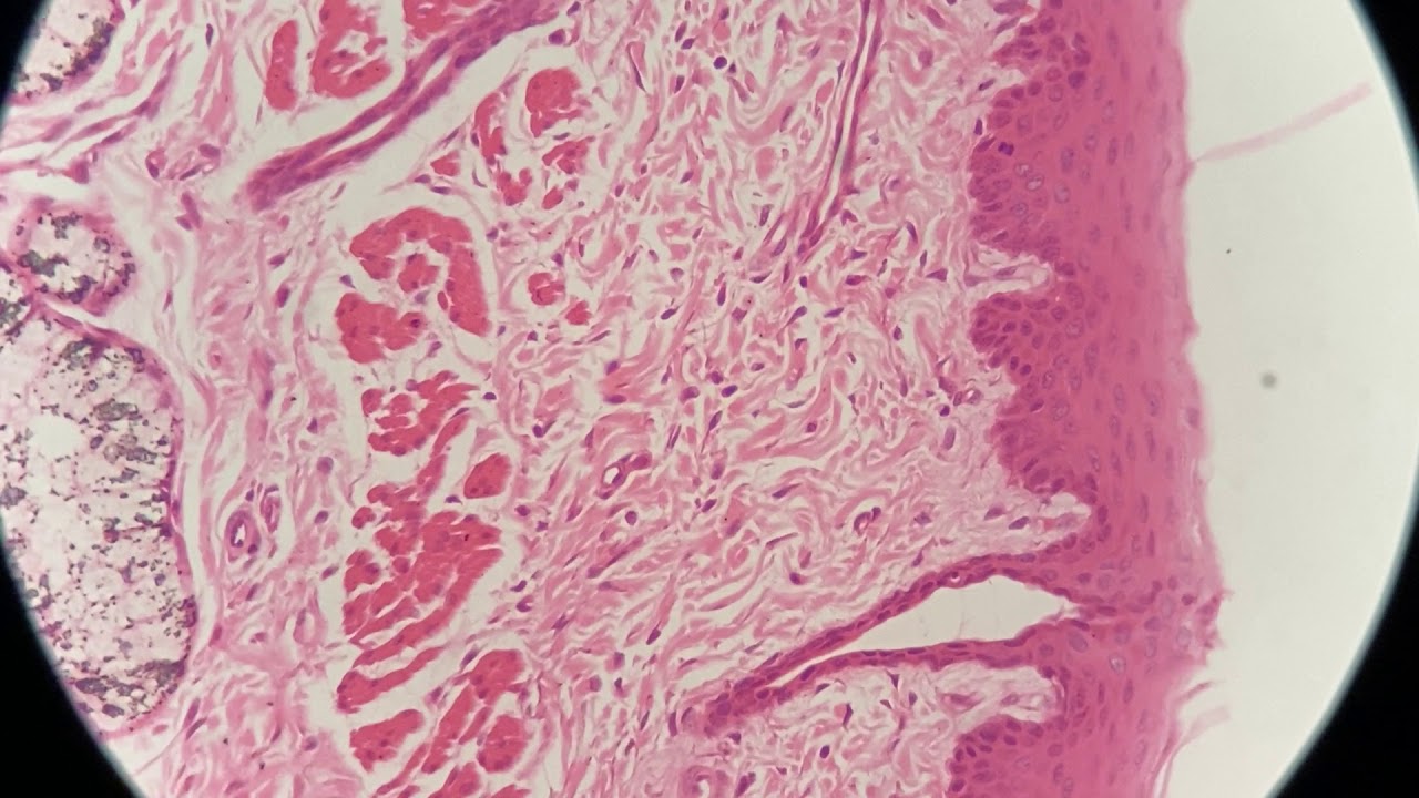 Epitélio estratificado (esôfago) - YouTube