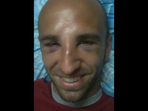 Getting my face caved in! - YouTube