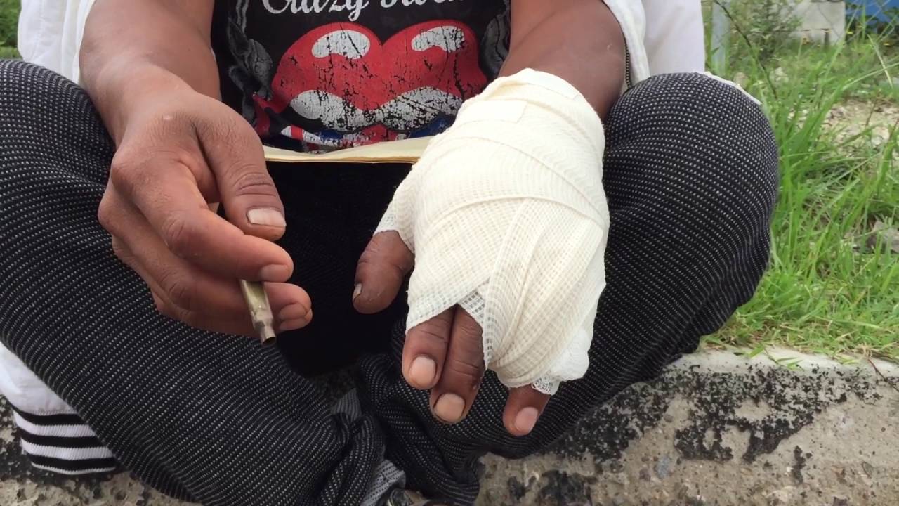 Testimonio de herido en Nochixtlan. - YouTube