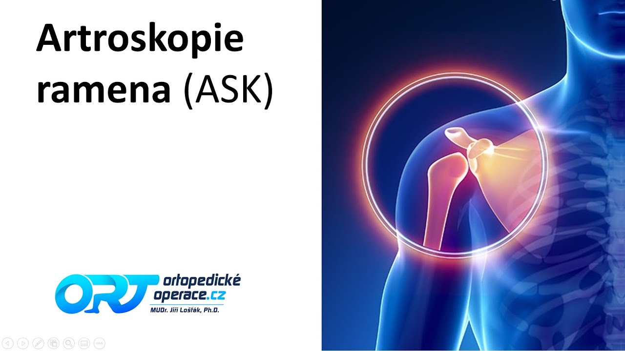 Artroskopie ramena - jaké jsou artroskopické možnosti ošetření ramena ...