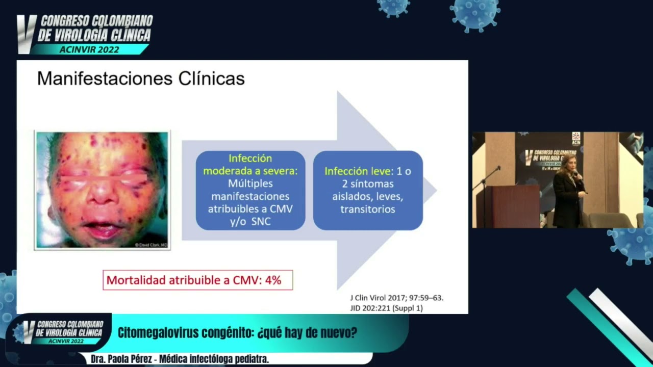 Citomegalovirus congénito: ¿Qué hay de nuevo? - Dra. Paola Pérez - YouTube
