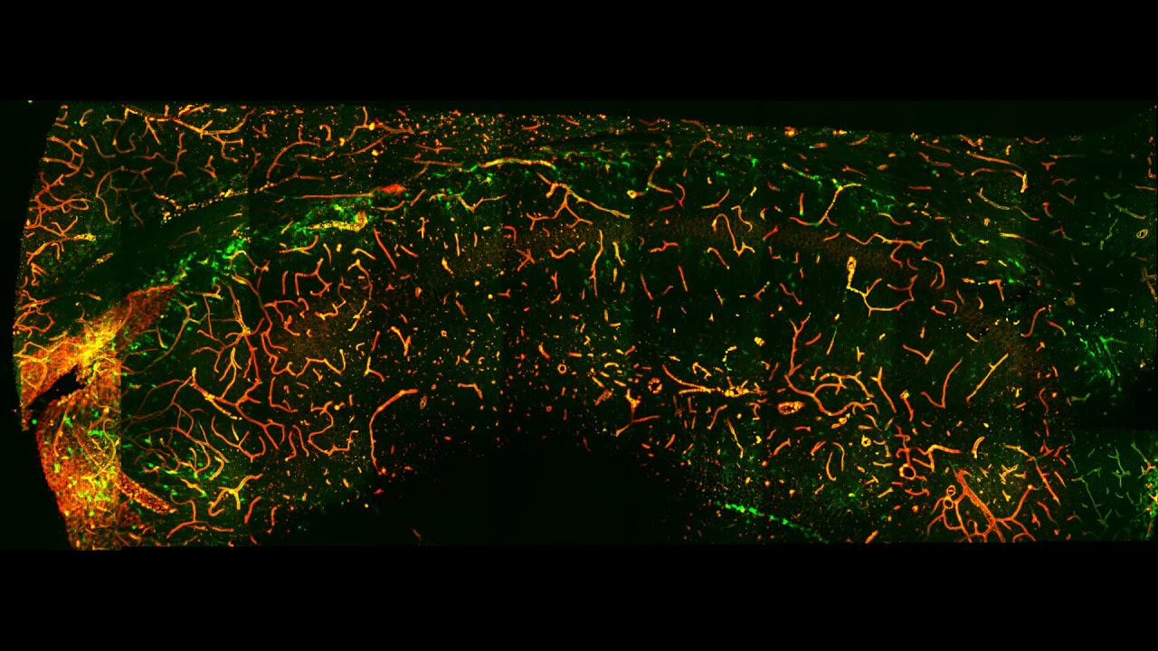 Expanded Hippocampus of Thy1-GFP transgenic-mice - YouTube