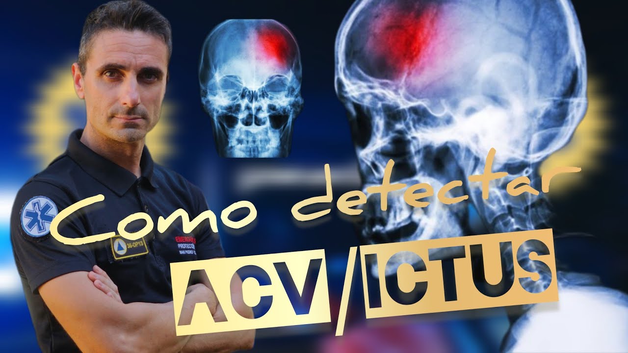 Como DETECTAR y ACTUAR ante un ICTUS/ACV - YouTube