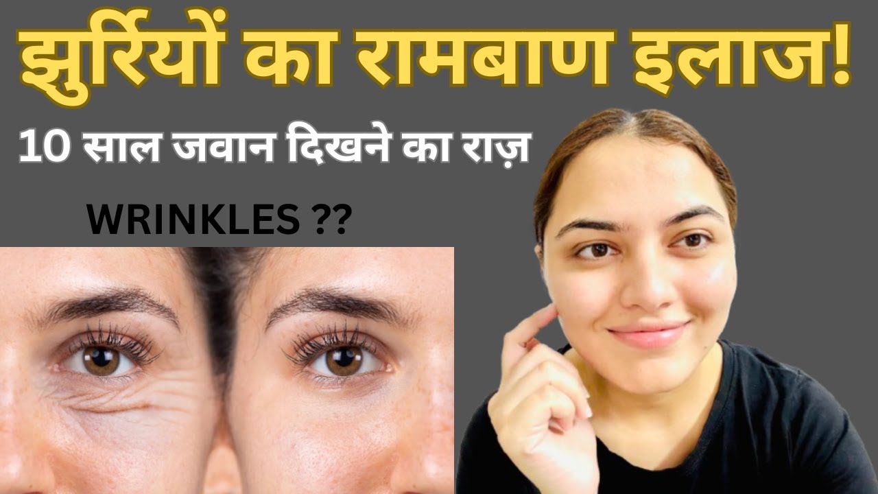 Tighten Loose Skin Under Eyes in 7 Days | Anti-Aging Home Remedies # ...