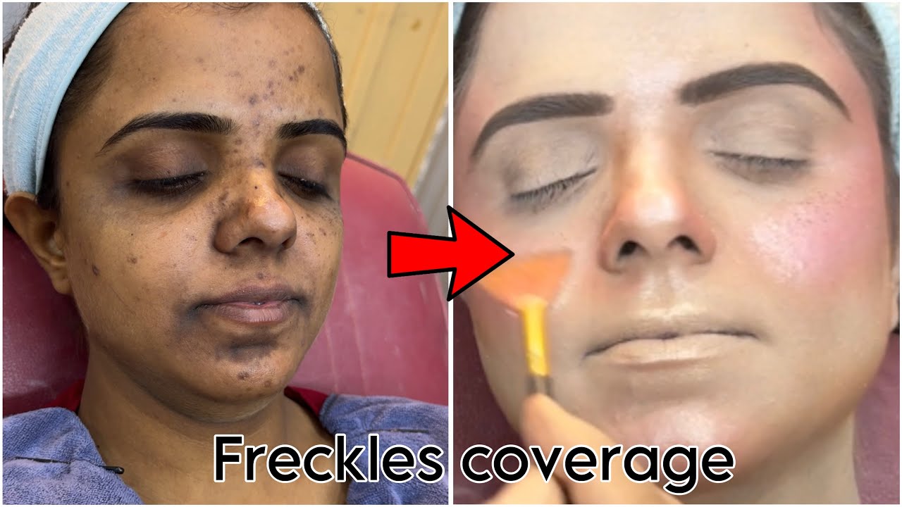 How to cover up freckles with base | discolouration coverage with base ...