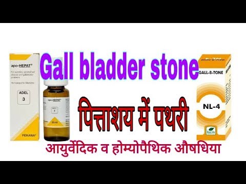 Stone Problem ( Gall bladder ) पित्ताशय में पथरी की प्रभावशाली ...