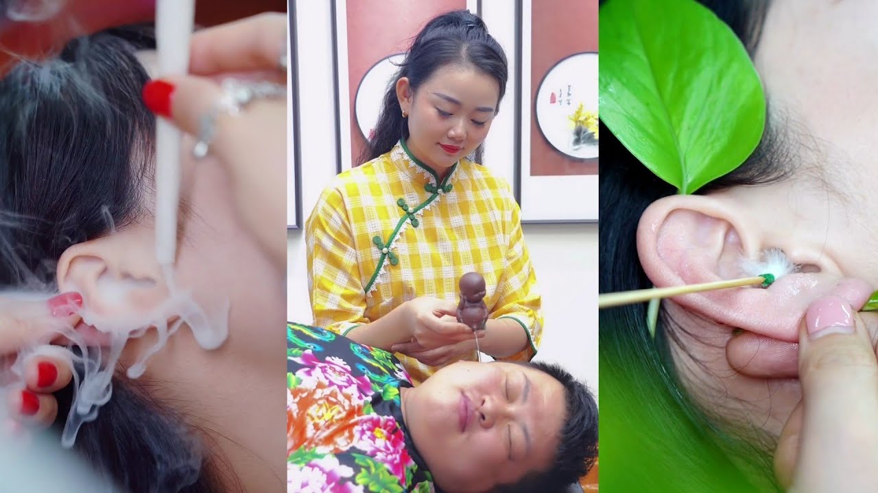 [ASMR] Satisfying Head Peeling, Face & Ear Cleaning | 100% You will ...